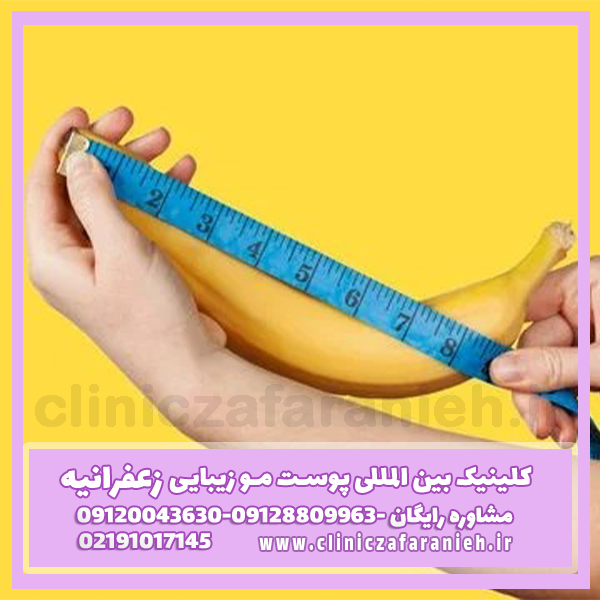 روش های کلفت کردن و بزرگ کردن آلت تناسلی چیست؟ کلینیک بین المللی پوست